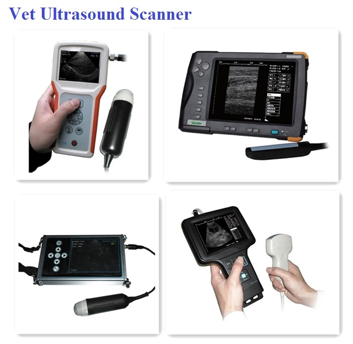 Ultrasonic Imaging System Laptop Scanner B Ultrasound (HBW-7) - China ...