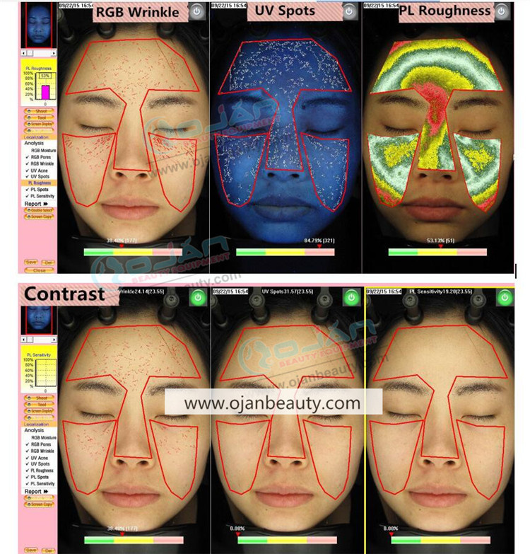 China Magic Mirror 3D Facial Skin Scanner Analyzer/Facial Skin Analyzer ...